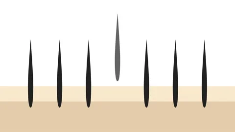 Hair loss concept illustration animation... | Stock Video | Pond5