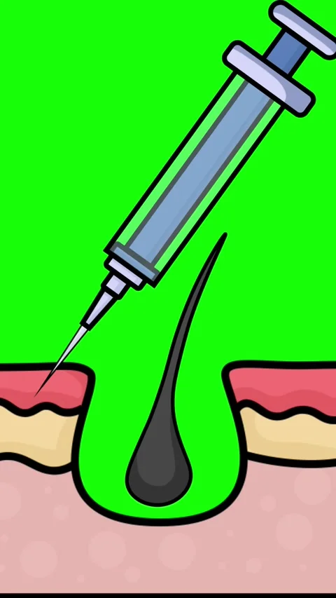 Injection Green Screen Stock Video Footage | Royalty Free Injection ...