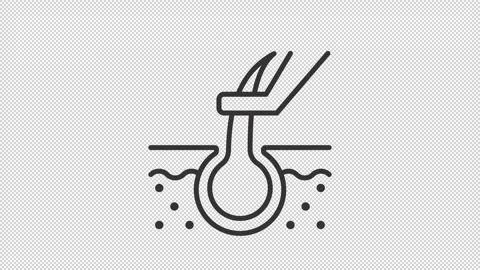 Hair Transplant Stock Video Footage | Royalty Free Hair Transplant ...