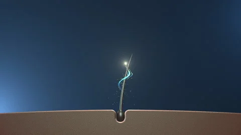 Hair Growth Animation Stock Videos – Royalty-Free HD & 4K Videos | Pond5