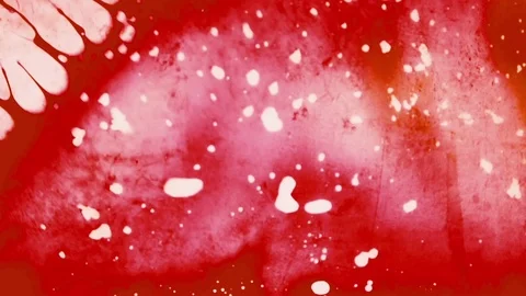 Bloodletting Stock Footage ~ Royalty Free Stock Videos | Pond5