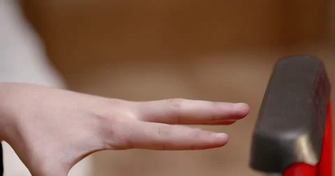 The hand of a disabled boy tries to reac... | Stock Video | Pond5