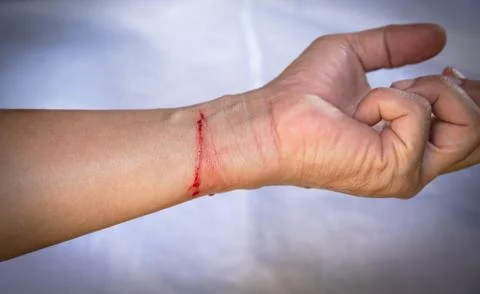 Cut Wrist Stock Photos & Images ~ Royalty Free Images | Pond5
