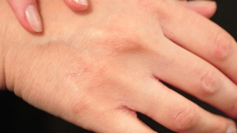 Skin Flakes Stock Footage ~ Royalty Free Stock Videos | Pond5