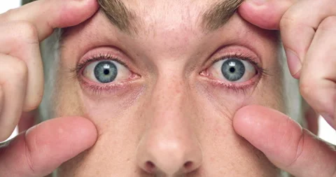Hands, open eyelid and face for man, tir... | Stock Video | Pond5