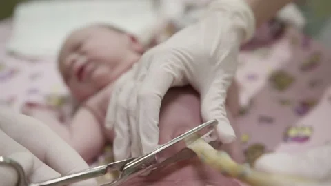 Hands with scissors cut the umbilical co... | Stock Video | Pond5