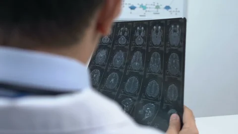 Happy patient looking at good mri brain ... | Stock Video | Pond5