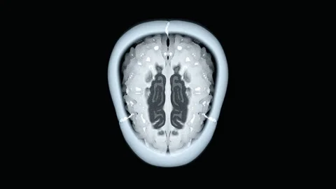 Head CT Scan Animation. | Stock Video | Pond5