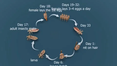 Head lice life cycle | Stock Video | Pond5