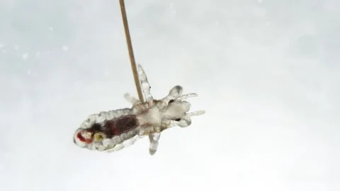 Head Louse Isolated Stock Videos – Royalty-Free HD & 4K Videos | Pond5
