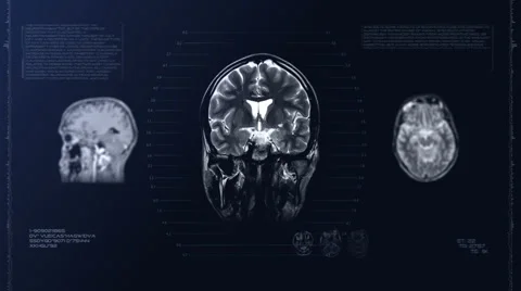 Head MRI scan. Loop. Xray | Stock Video | Pond5