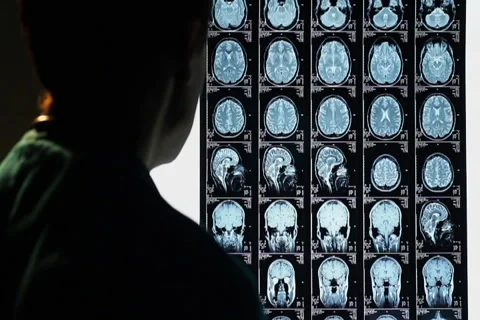 Head MRI, surgeon observing skull brain... | Stock Video | Pond5