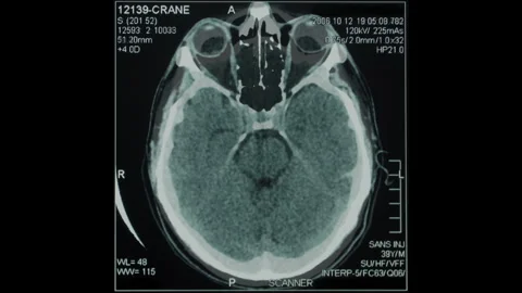 Head Scroller Stock Footage ~ Royalty Free Stock Videos | Pond5