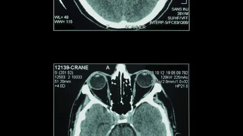 Head Scroller Stock Footage ~ Royalty Free Stock Videos | Pond5