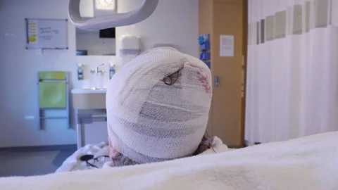 Head wound victim in hospital. Close up ... | Stock Video | Pond5