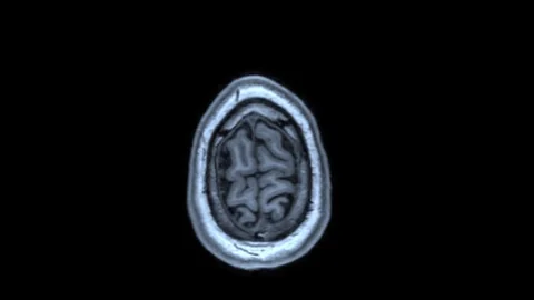 Healthy adult caucasian male brain scan ... | Stock Video | Pond5