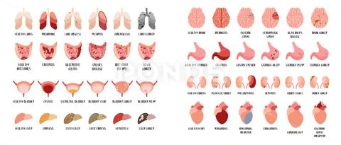 Healthy and unhealthy internal human organs. Brain, lungs, liver, heart ...