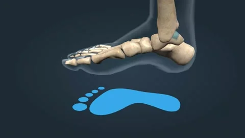 Healthy foot skeleton and blue footprint | Stock Video | Pond5