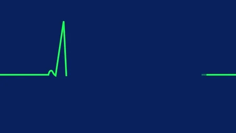 Heart Beat Line light , Heart Beat EKG M... | Stock Video | Pond5