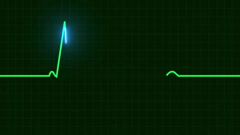 Heart Beat Line neo light , Heart Beat E... | Stock Video | Pond5