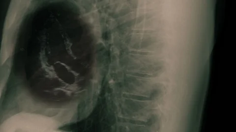 Beating Human Heart Stock Video Footage | Royalty Free Beating Human ...