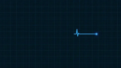 Heart Beating Line Animation on a Grid B... | Stock Video | Pond5