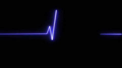 Heart impulse beat. Heart rate and pulse... | Stock Video | Pond5