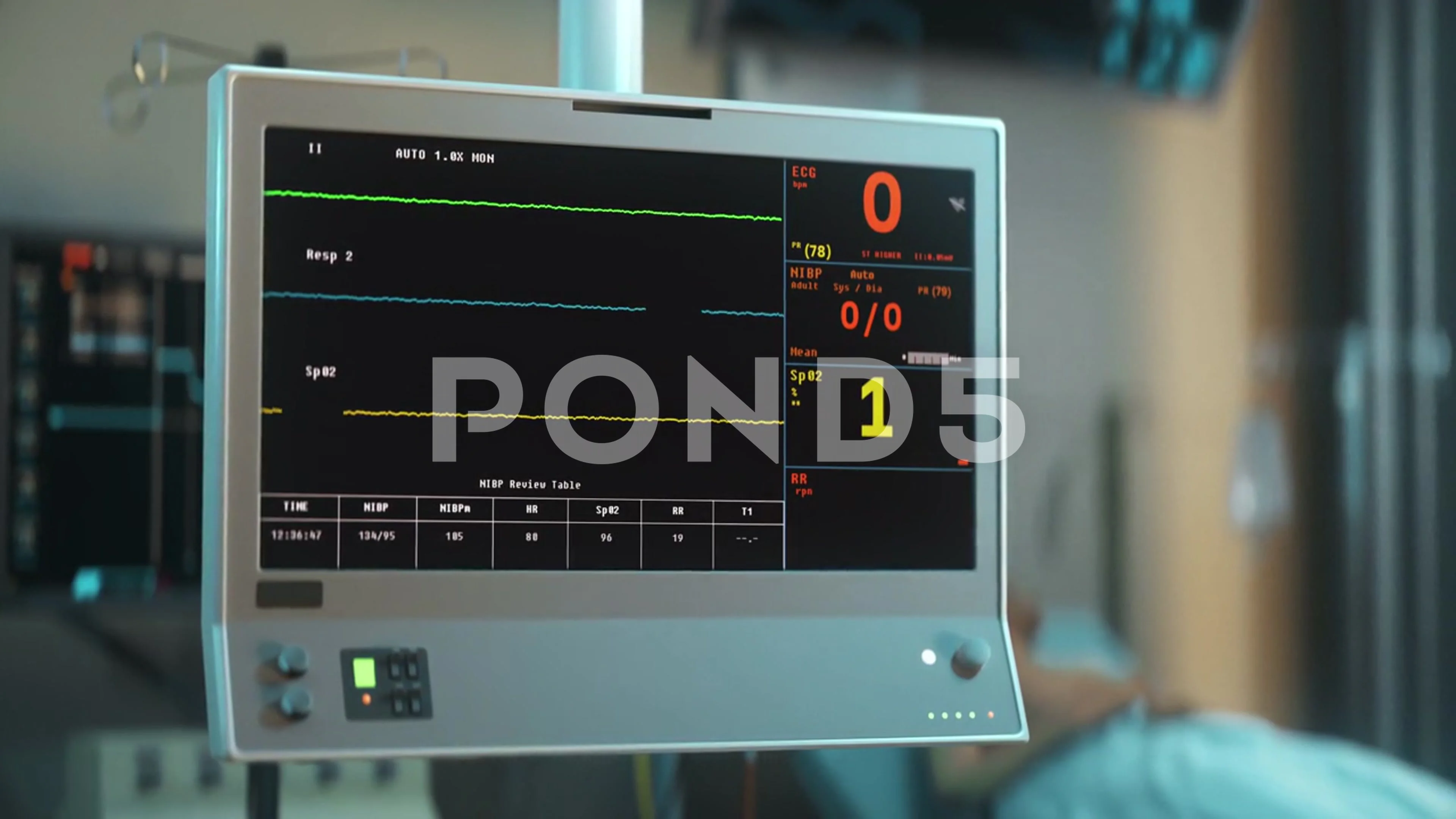 Cardiac Monitor Flat Line