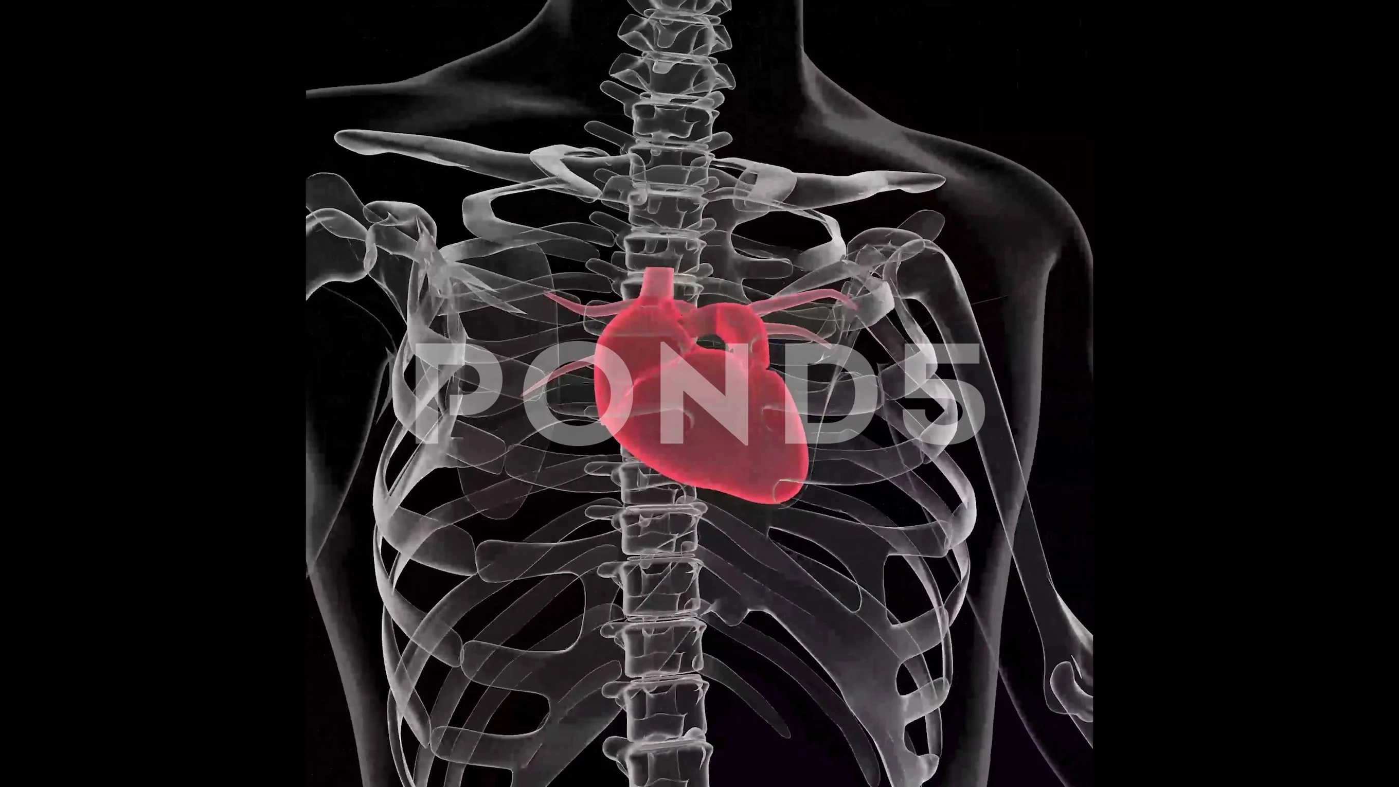 Xray Heart Labeled