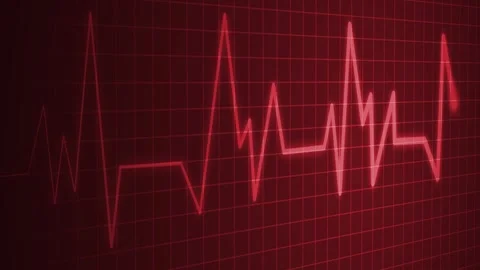 Heartbeat Line on ECG Monitor Animation,... | Stock Video | Pond5