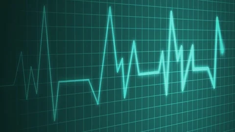 Heartbeat Line on ECG Monitor Animation,... | Stock Video | Pond5