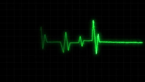 Heartbeat Monitor Animated Video, Heartb... | Stock Video | Pond5