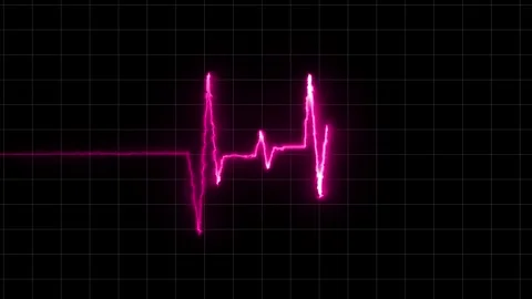 Heartbeat Monitor Animated Video, Heartb... | Stock Video | Pond5
