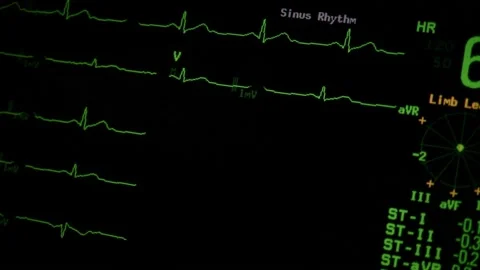 Hospital Heart Rate Monitor Flatline