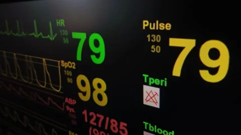 heartbeat pulse monitoring with electroc... | Stock Video | Pond5