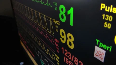 heartbeat pulse monitoring with electroc... | Stock Video | Pond5