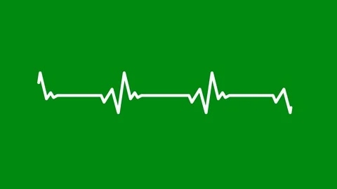 Heartbeat Pulse Rate animation Green Scr... | Stock Video | Pond5