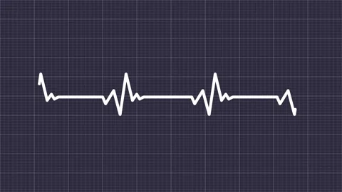 Heartbeat Pulse Rate animation with grid... | Stock Video | Pond5
