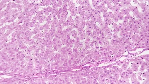 High magnification 200x of human liver s... | Stock Video | Pond5