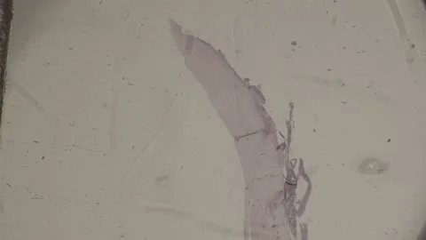 High-Magnification Human skin Under micr... | Stock Video | Pond5