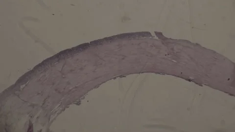 High-Magnification of Human Skin Under M... | Stock Video | Pond5