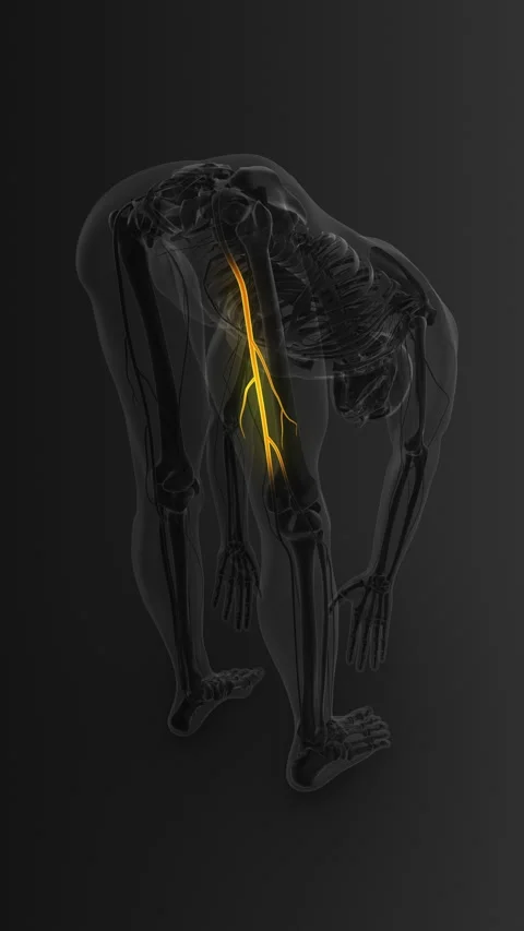 Highlighted Sciatica Nerve in Bending Ma... | Stock Video | Pond5
