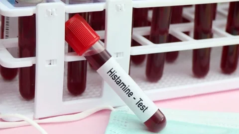 Histamine test, blood sample to analyze ... | Stock Video | Pond5