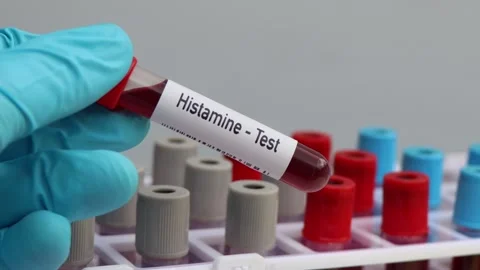 Histamine test, blood sample to analyze ... | Stock Video | Pond5