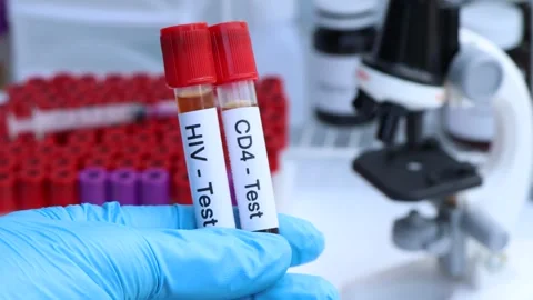 HIV test and CD4 test to look for abnorm... | Stock Video | Pond5