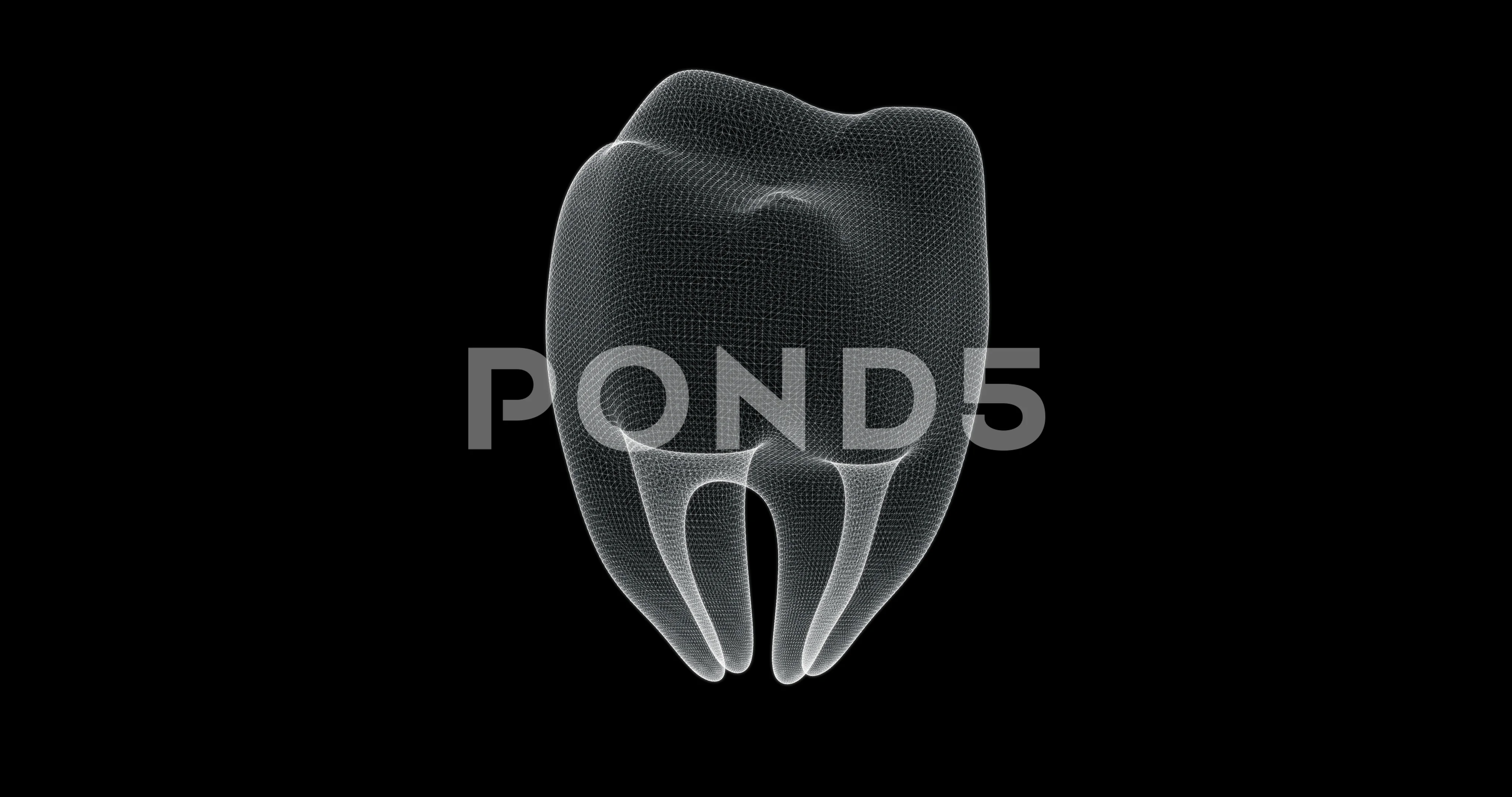Molar Tooth 3d