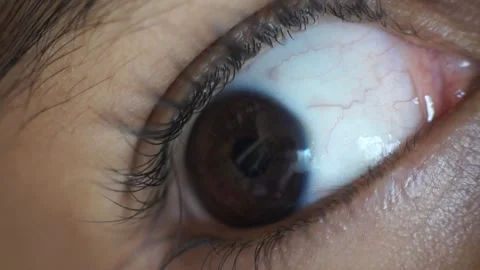 Horror Macro Shot Of Scared Girl Eye Wit... | Stock Video | Pond5