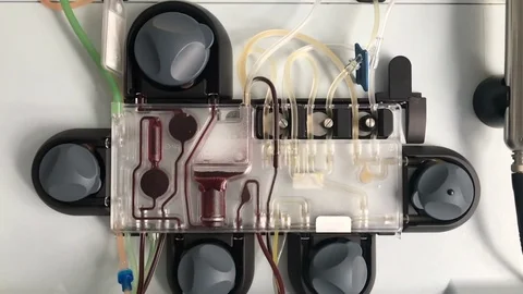 Stem Cell Donation Stock Video Footage | Royalty Free Stem Cell ...