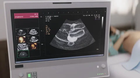Hospital Diagnostic Scan Monitor Determi... | Stock Video | Pond5