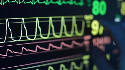 hospital doctor's hand monitoring heart ... | Stock Video | Pond5
